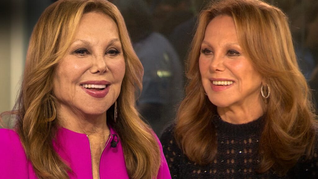 Famous People Before And After Plastic Surgery